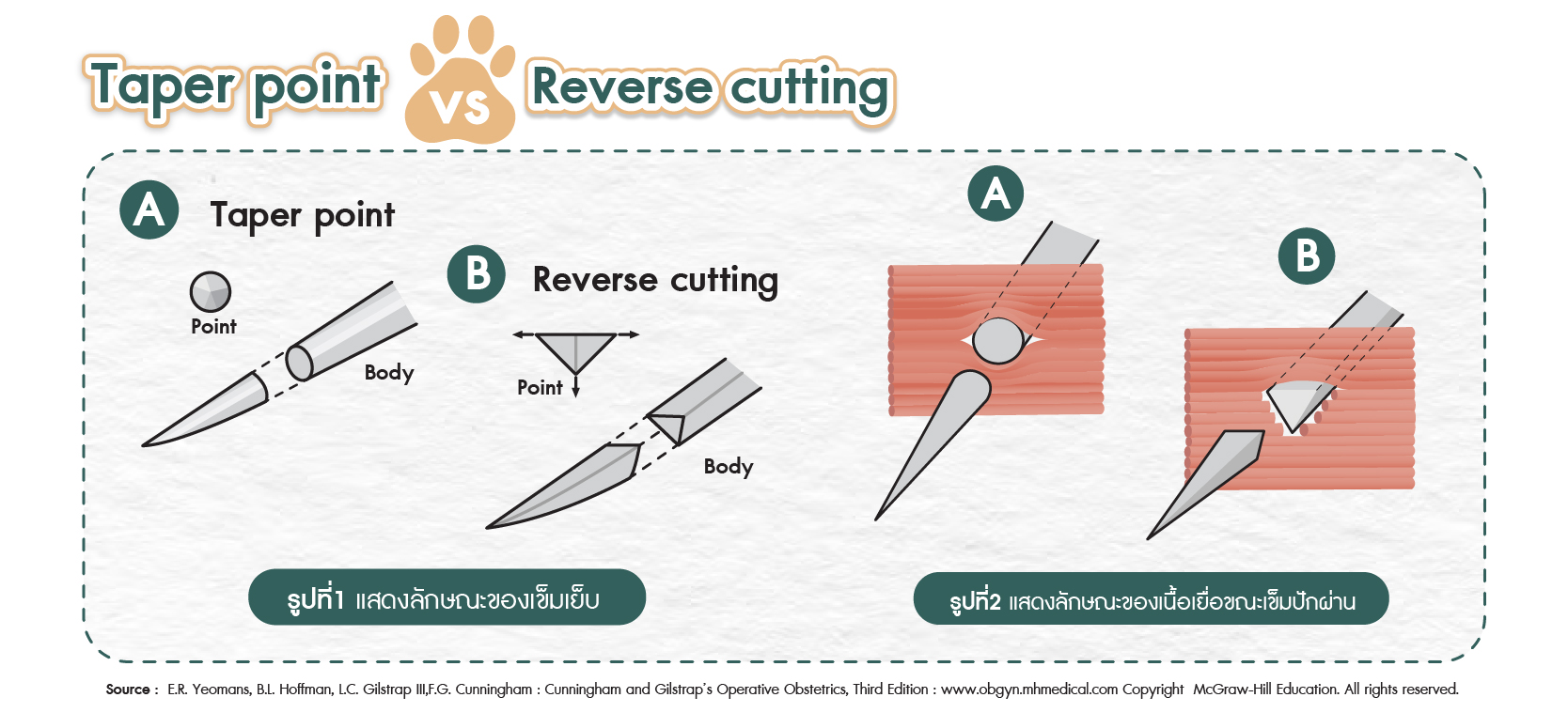 ความแตกต่างของเข็มเย็บ Tapper point และ Reverse cutting | Best Equipment Center Co., Ltd. (BEC)